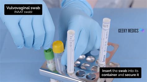 Vaginal Swabs Osce Guide Chlamydia Gonorrhoea Geeky Medics