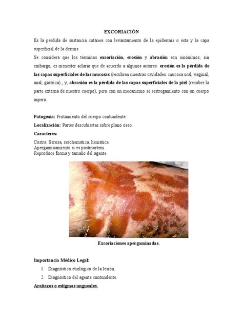 Definición Y Tipos De Excoriaciones Pdf