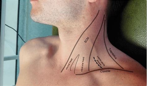 Triangles Of The Neck