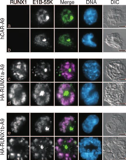 E4orf6 And Runx1 Differentially Affect The Localization Of E1b 55k In