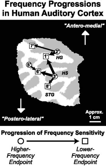 Summary Of 6 Frequency Progressions In Human Auditory Cortex Arrows Download Scientific