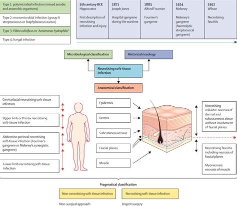Necrotizing Fasciitis Progression