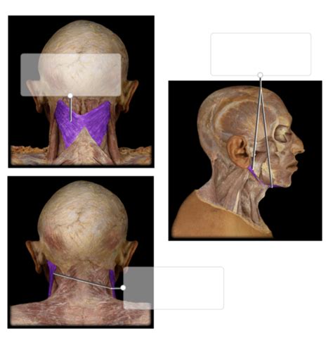 Lab 9 PreLab Flashcards Quizlet