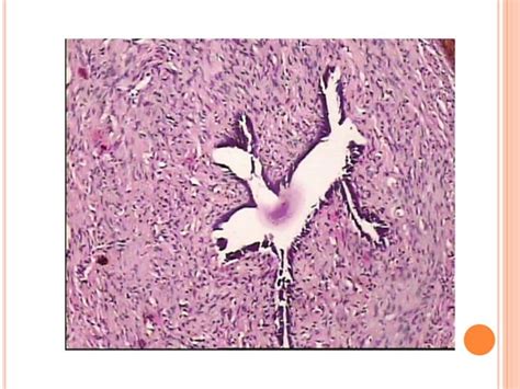 0102 Ambiguous Genitalia Case Presentationppt