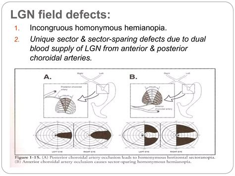 Visual Pathway And Its Defects Pptx