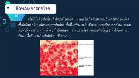 Gram Negative Cocci Pptx