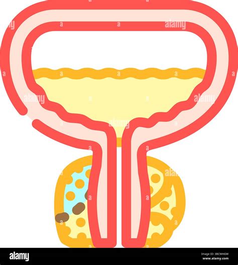 Prostatectomy Urology Color Icon Vector Illustration Stock Vector Image
