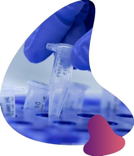 Controlling For Contamination In Qpcr Testing Lgc