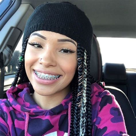 Pinterest Tasty Doll🍭 Follow For More Braces Girls Cute Braces