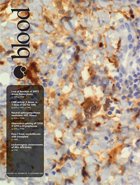 A Human Genome Editingbased Mllaf4 All Model Recapitulates Key Cellular And Molecular