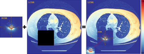 Figure From A Two Stage Convolutional Neural Networks For Lung Nodule Detection Semantic Scholar