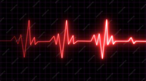 Premium Photo The Heartbeat Electrocardiogram Ekg Monitoring In An