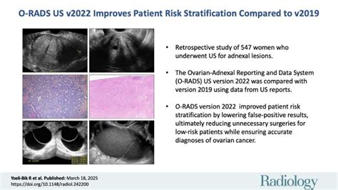 Radiology Orads Ultrasound Ovariancancer Clinicalresearch
