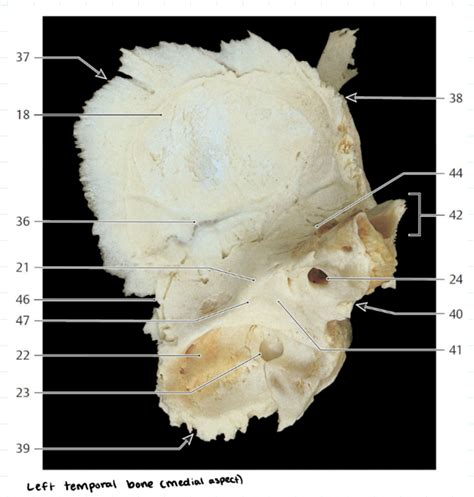 Temporal Bone Left Medial Diagram Quizlet