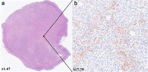 He And Ihc Of 4t1 Tumor A And B Download Scientific Diagram
