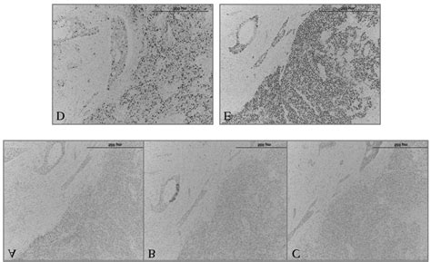 Immunohistochemical Staining For Er Pr Her2 Ki67 And P63 A Er