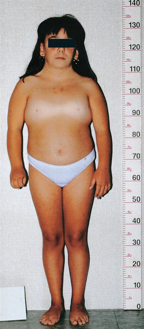 Human Birth Defects Clinical Tree