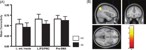 Functional Connectivity Analysis Of Visual Verbal Working Memory A Download Scientific
