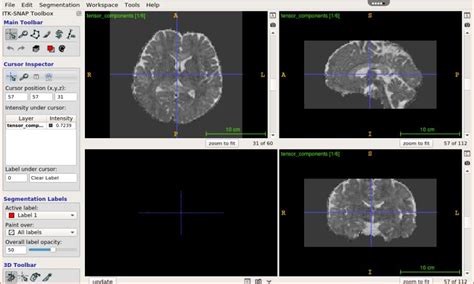 rollapp application for segmenting structures in 3d