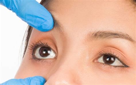 눈 흰자위에 생긴 점 ‘이렇게 변하면 병원으로 당신의 건강가이드 헬스조선