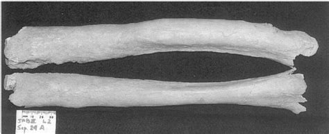 Saber Shin Tibia From One Adult Individual Download Scientific Diagram