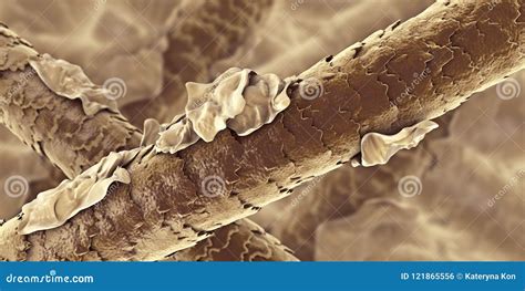 Dandruff Flake Under Microscope