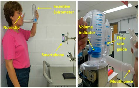 Employing An Incentive Spirometer To Calibrate Tidal Volumes Estimated