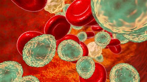 Candidiasis Fungal Infection Stock Illustrations 314 Candidiasis