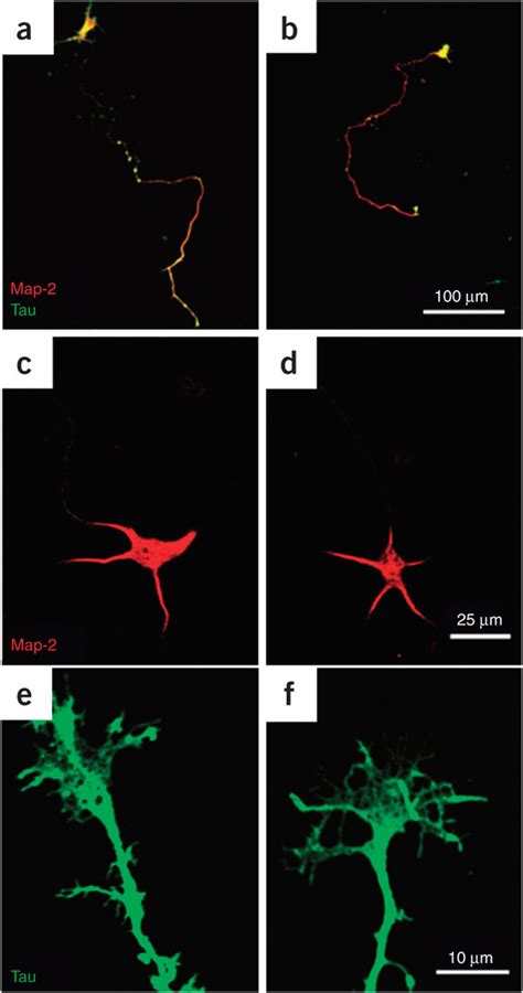Immunocytochemistry Of Cultured Motoneuronsab Overall Appearance Of