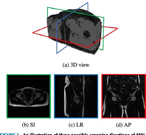 Figure 1 From An Unsupervised Learning Approach To 3d Rectal Mri Volume Registration Semantic
