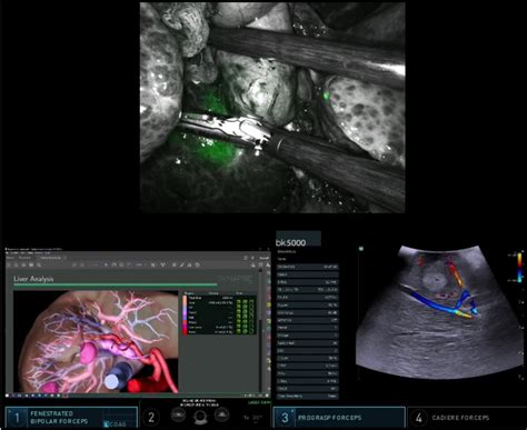 The Integrated Robotic Platform Permits The Simultaneous Visualization