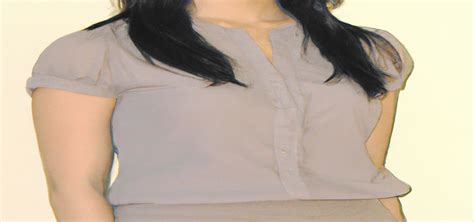 Hypopigmentation In Focus Breaking Stereotypes Theskinartistry