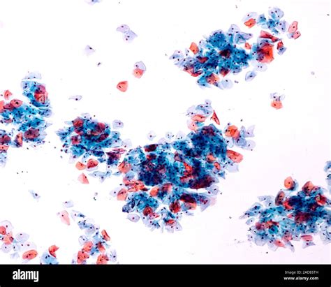 Vaginal Smear Stained With Papanicolau Method Light Micrograph The