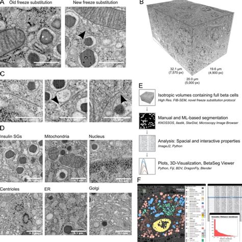 Raw Fib Sem Data And Workflow For Sample Preparation Imaging Download Scientific Diagram