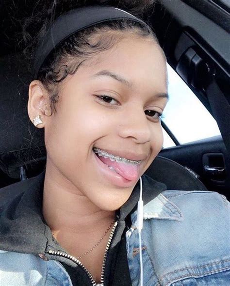Me Am I Cute Damn If I Am Dm Me Cute Girls With Braces Teeth Braces