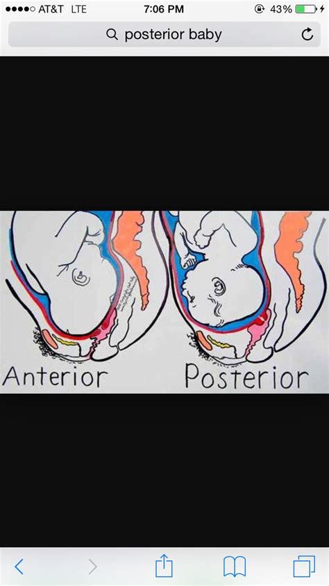 OA OP Midwifery Natural Pregnancy Birth Doula