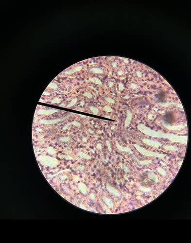 Microscope Flashcards Quizlet