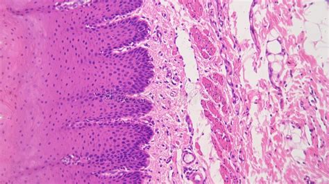 Stratified Squamous Epithelium Filmed By Microscope With 200x Against Bright Field Stock Footage
