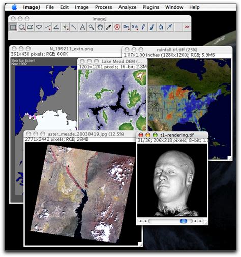 Angiogenesis Analyze For Imagej Software Horizondelta