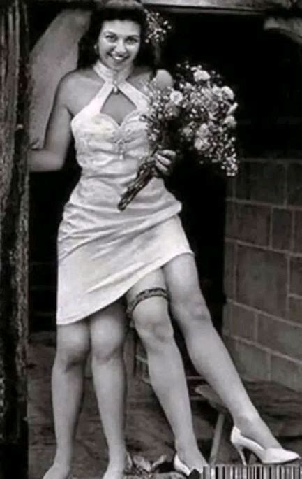True Story Of Josephine Myrtle Corbin The Lady Born With Four Legs