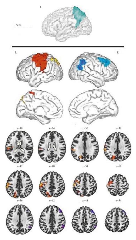 Functional Connectivity Analysis Based On The Region Of Interest Download Scientific Diagram
