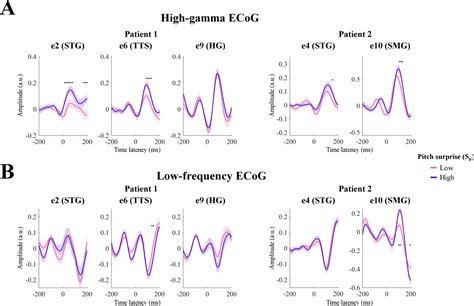 Figures And Data In Cortical Encoding Of Melodic Expectations In Human Temporal Cortex Elife