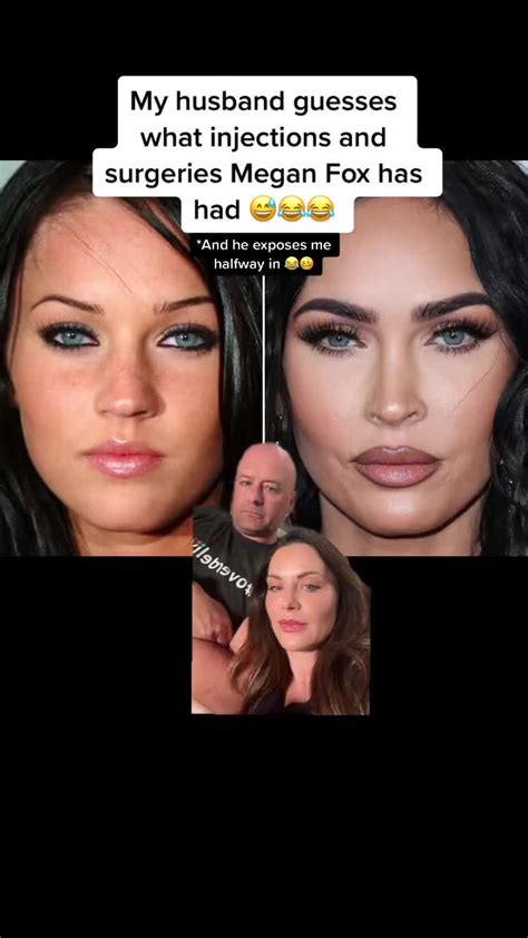 Megan Fox Plastic Surgery Before After