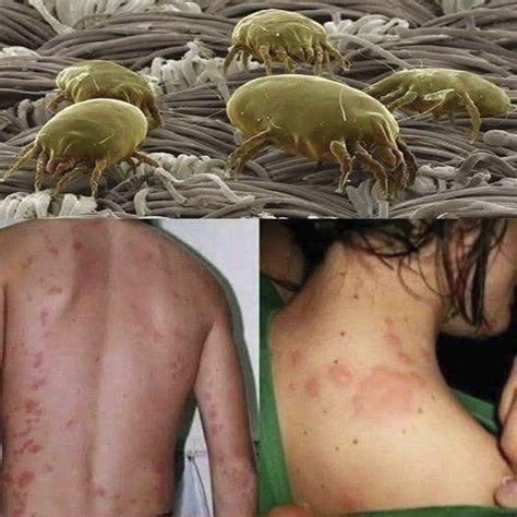 Elimina Los Millones De ácaros Que Se Acumulan En El Colchón Lo Que