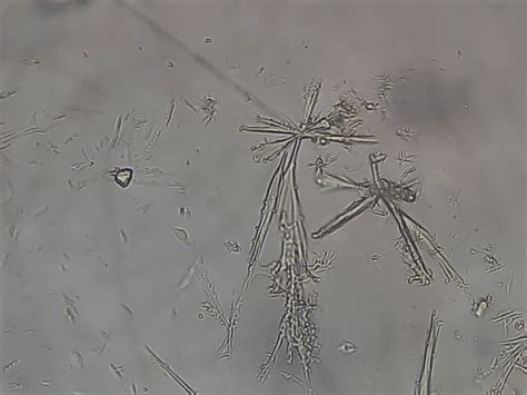 Crystal Morphology Archives Medical Notes