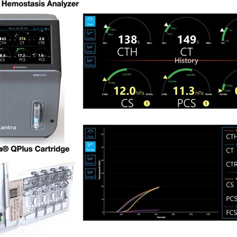 Rotem Sigma And Cartridge The Figure Also Represents The Tests Download Scientific Diagram