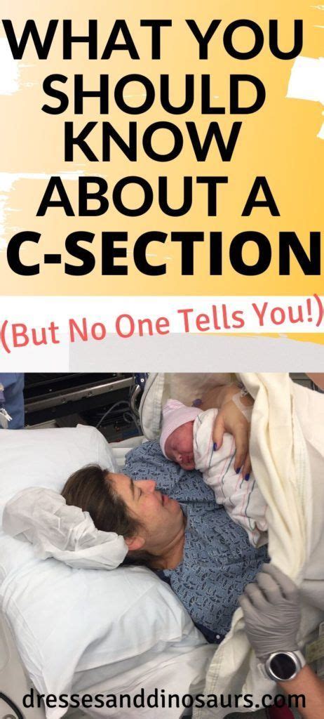 What You Dont Know About A C Section Dresses And Dinosaurs Sleep