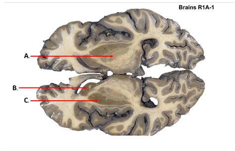 Identify The Structures Labelled A B And C Chegg Com