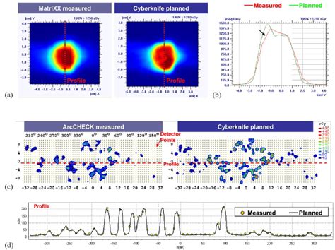 the 2d dose comparisons and the profile dose comparisons between the