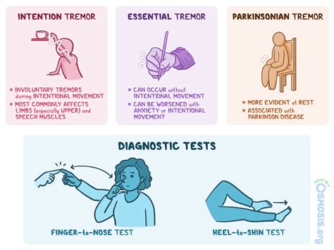 Essential Tremor And Balance Problems Mapasgmaes